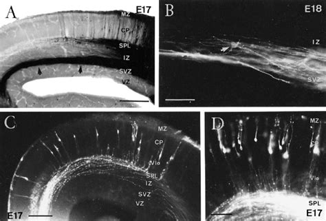 Development Of Callosal Connections A Result Of A Typical Injection
