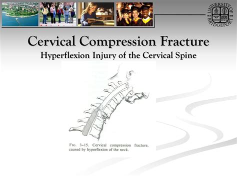James J Lehman Dc Mba Dabco Dx 612 Orthopedics And Neurology Ppt