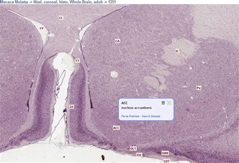 Sides Of Sentience Pleasure Centers Septal Nuclei Nucleus Accumbens Subthalamic Nuclei And