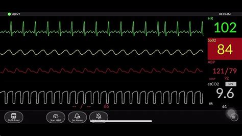 heart monitor sound wav