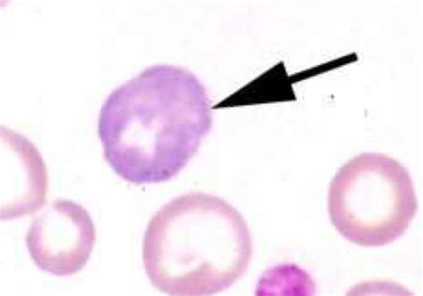 Clin Path Erythrocytes Flashcards Quizlet