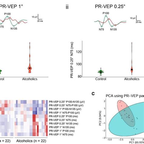 Pattern Reversal Visual Evoked Potential Pr Vep Shows Significant