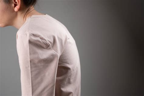 ¿qué Es La Cifosis Y Por Qué Ocurre 6 Consejos Para Tratarla Mejor