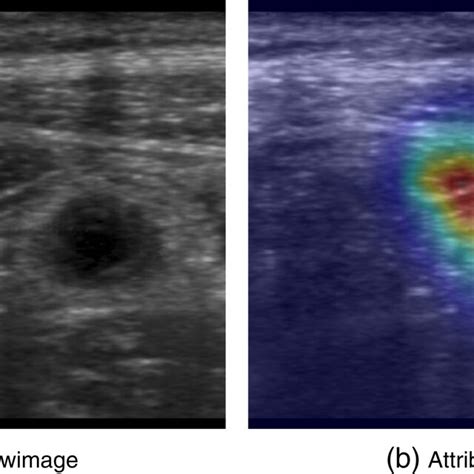 An Example Of Attribution In Medical Image Classification A A Raw Download Scientific