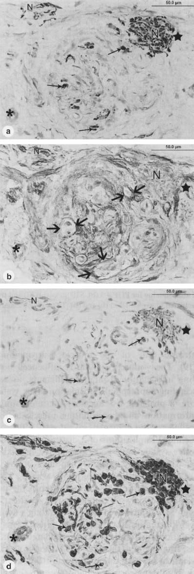 Large Ruffini Corpuscle In A Dic Ligament In Sections Stained For Pgp
