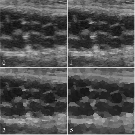 Descending Variance Graphs Applied At Various Radii In Pixels To An Download Scientific