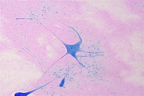 Neuroglia Microscope
