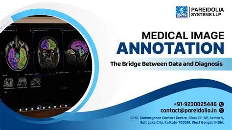 Pareidolia Blog Archive Deep Learning In Medical Imaging Explained Pareidolia Systems