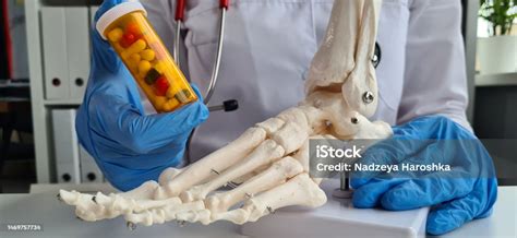 관절 통증 약 및 고통스러운 부상 또는 관절염 의학 건강 관리 및 치료를위한 상징 건강 진단에 대한 스톡 사진 및 기타 이미지