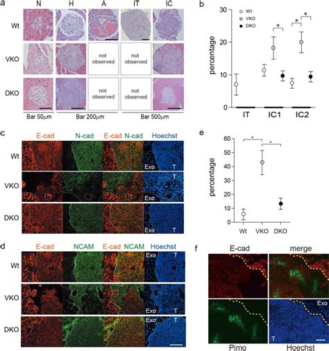 A Microscopic Features Of The Tumors Representative Hande Stained