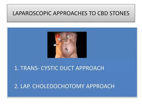 Lap Cbd Ppt Pptx