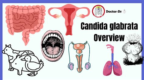 Candida Glabrata Overview