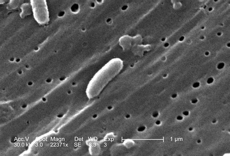 Free Picture Vibrio Cholerae Bacteria Serogroup Magnified 22371x