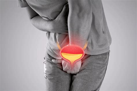 Cistectomia Radical O Que É E Como Funciona A Cirurgia