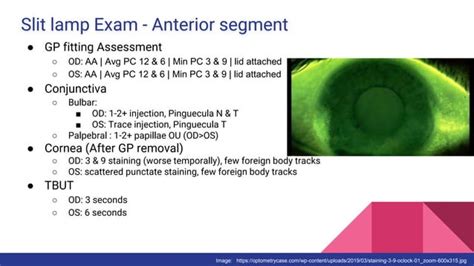 Pathological Myopia And How It Can Effect Cl Rx Ppt