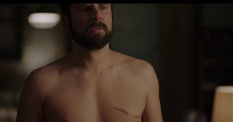 Did James Roday Have A Heart Operation Surgery Rumor Details