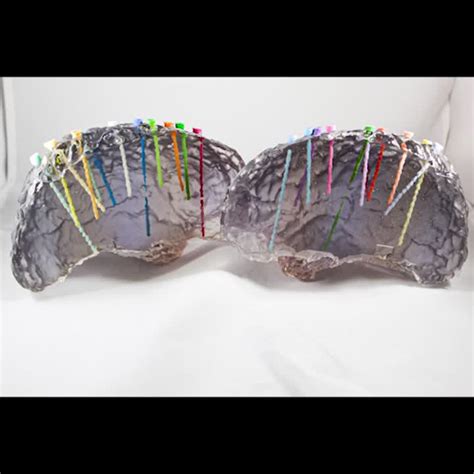 Stanford 3d And Quantitative Imaging Laboratory On Linkedin Healthcare