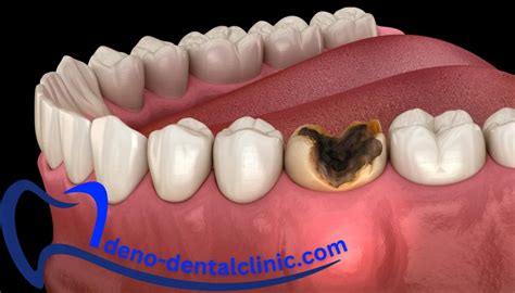 بهترین دندانپزشکی شمال تهران دندانپزشکی دنو
