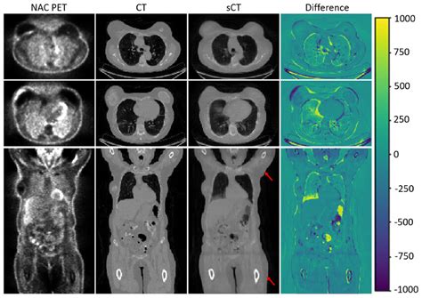 Comparison Of True CT And SCT Images On A Female Received Breast Download Scientific Diagram