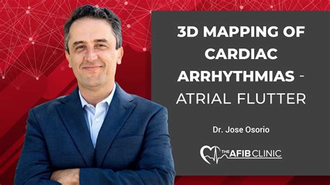 3d Mapping Of Cardiac Arrhythmias Atrial Flutter Dr Jose Osorio