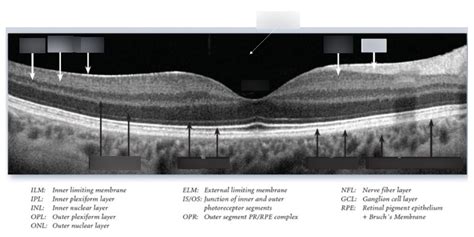Retinal Layers On Oct Diagram Quizlet