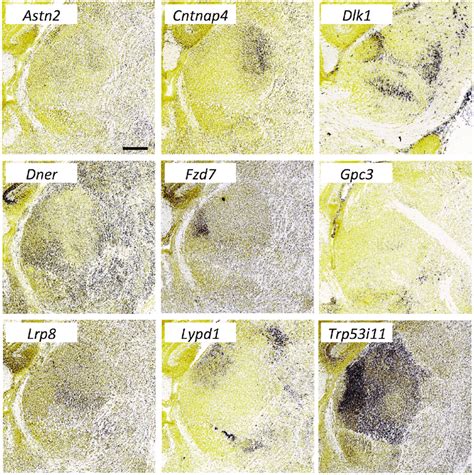 Expression Of Genes Encoding Miscellaneous Surface Or Secreted