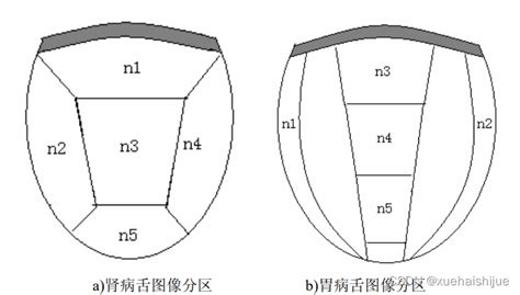 基于深度学习面向中医诊断的舌象图像分割系统 舌诊图像识别 csdn博客
