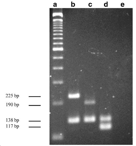 Multiplex Pcr Assay For Simultaneous Detection Of Cfb And Erythromycin
