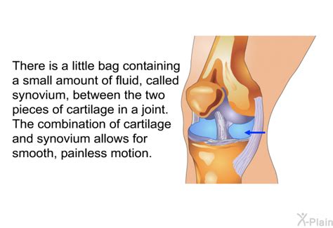 Infectious Arthritis