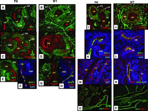 expression of wt1 muc1 e cadherin clmn oatp h aqp 2 and ck 7 in