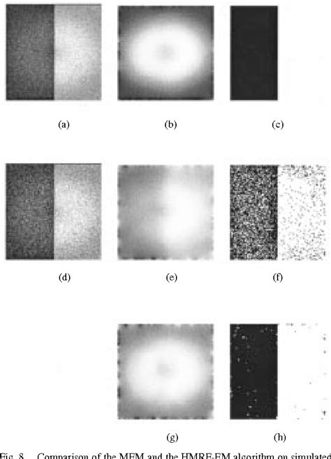 Figure 8 From Segmentation Of Brain Mr Images Through A Hidden Markov