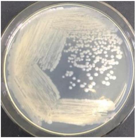 Bacillus Subtilis Colony