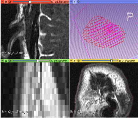 Clarification Re Rtstruct Display Support 3d Slicer Community