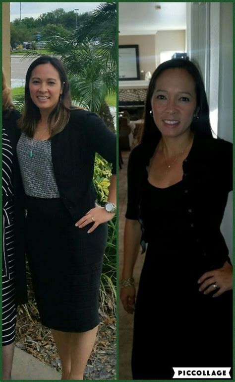 Chiropractor Decompression Therapy