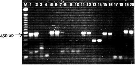 Colletotrichum Isolates From Mango Fruits Identified As C
