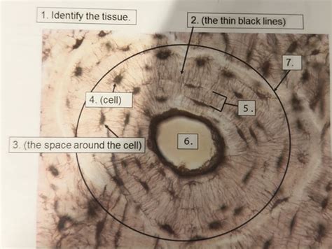 Chapter 3 Part 1 Identify Bone Connective Tissue Flashcards Quizlet