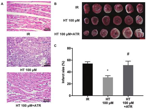 Effects Of Atr On Ht Cardioprotection In Myocardial Ischemia