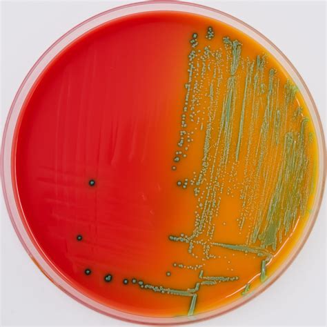 Reference Material For Rapidlmono Alternative Method For Iso 11290 • Biosistostandard