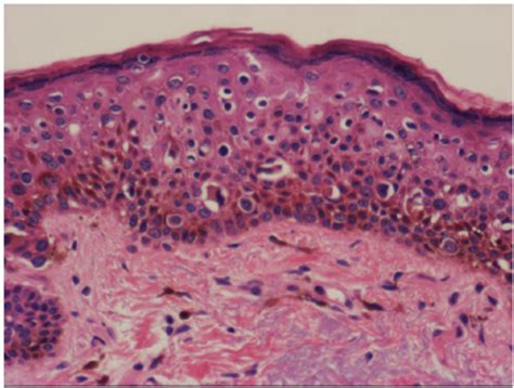 Melanocyte Histology