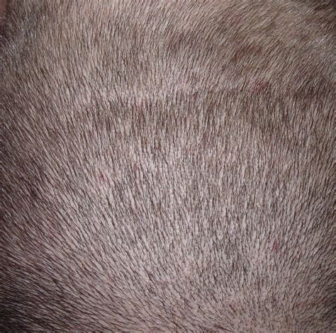 Scalp By Tmm Textures On DeviantArt