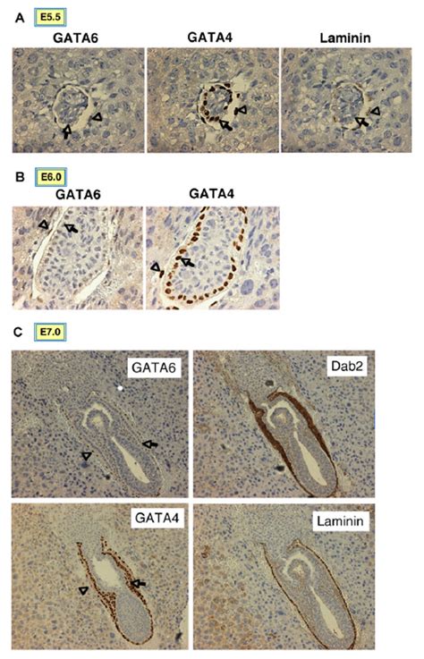 Gata4 Immunohistochemistry Gene Expression Assay Gxd