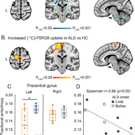 diffusion tensor imaging dti tractograpy the color coding of