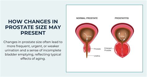 What Causes Enlarged Prostate Understanding Bph Triggers Purehealth