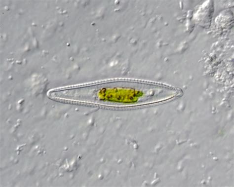 273 Best Diatoms Images On Pholder Microscopy Micro Porn And Planted Tank