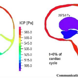 ICP Dynamics Between A Normal Subject And A Hydrocephalic Patient Download Scientific Diagram
