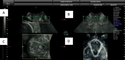 Image Of The Three Orthogonal Planes A Mid Sagittal Plane B Download Scientific Diagram