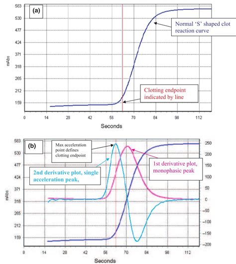 Clot Reaction Curves Contain The Same Elements — A Plot Of