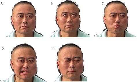 Artificial Intelligence Based Facial Recognition And Facial Symmetry