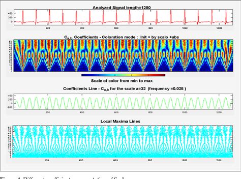 Figure 4 From A Hybrid Deep Learning Approach For Ecg Based Arrhythmia