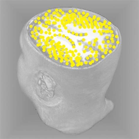 typical 3d sift keypoints detected on a 3d brain volume download